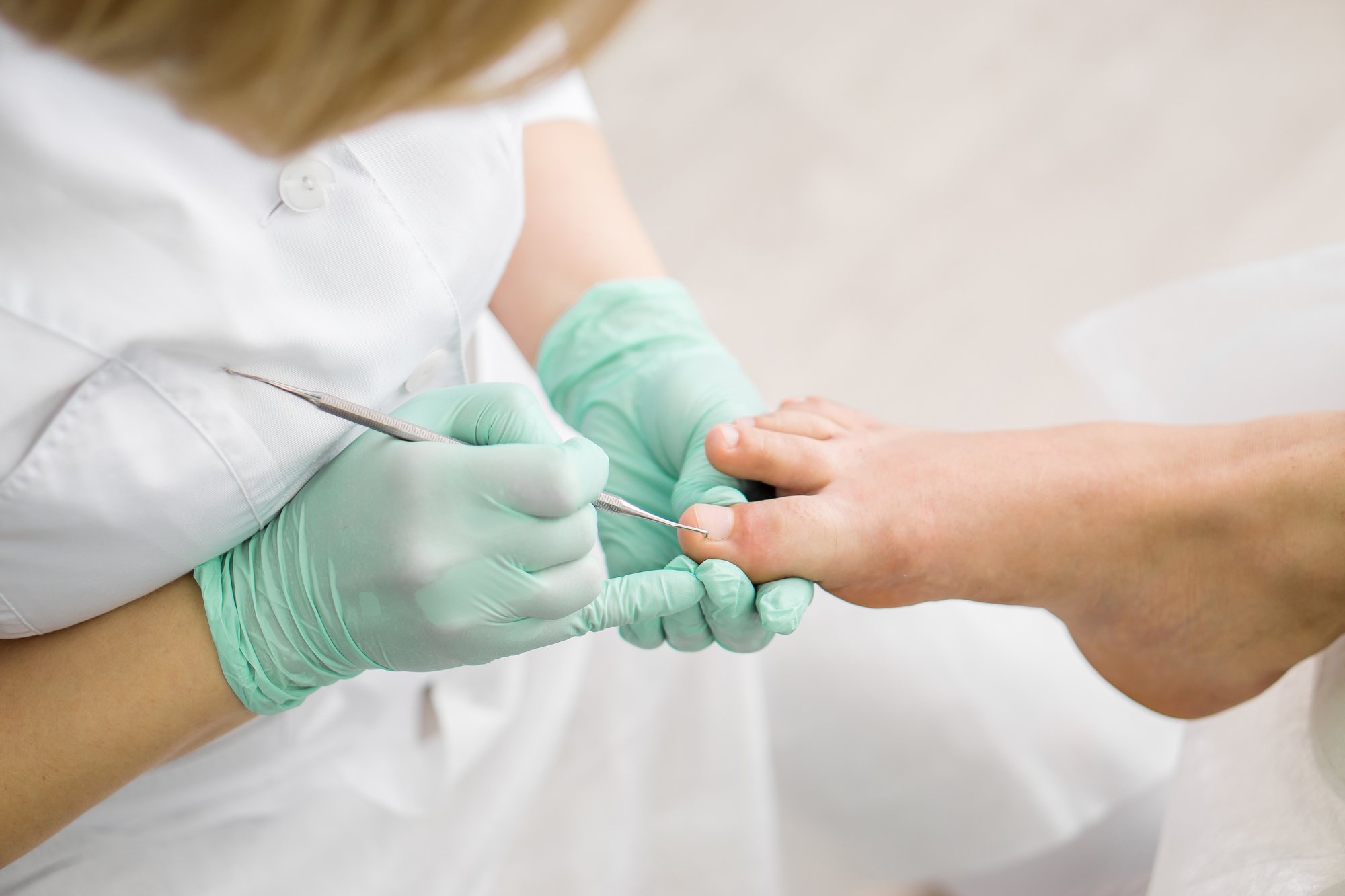 Comment soigner efficacement un ongle incarné ? - Kit Polygel ...